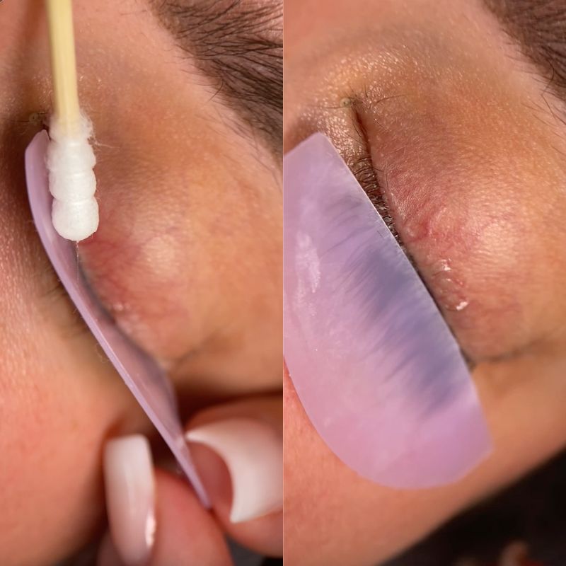 GLUELESS FLAT RODS FOR GLUELESS TECHNIQUE